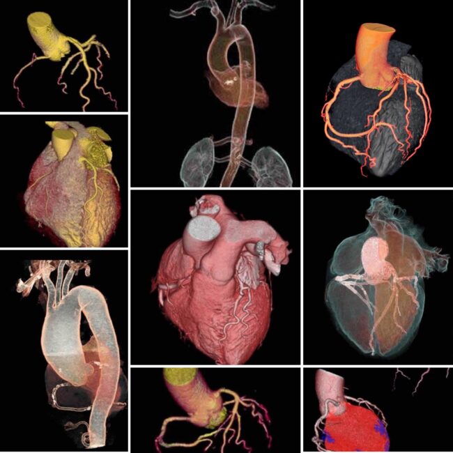 Arineta Cardio Imaging - CT Scan Machine