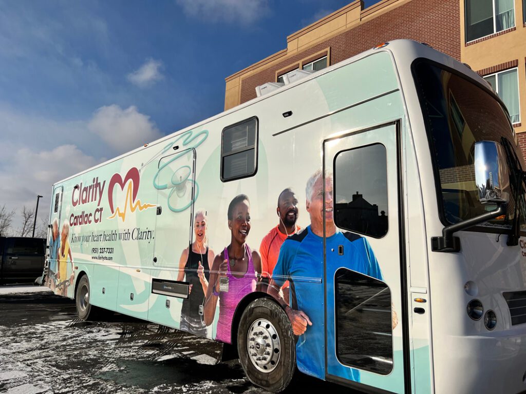Mobile Cardio CT Scan Machine with Thoracic Imaging | Mobile SpotLight